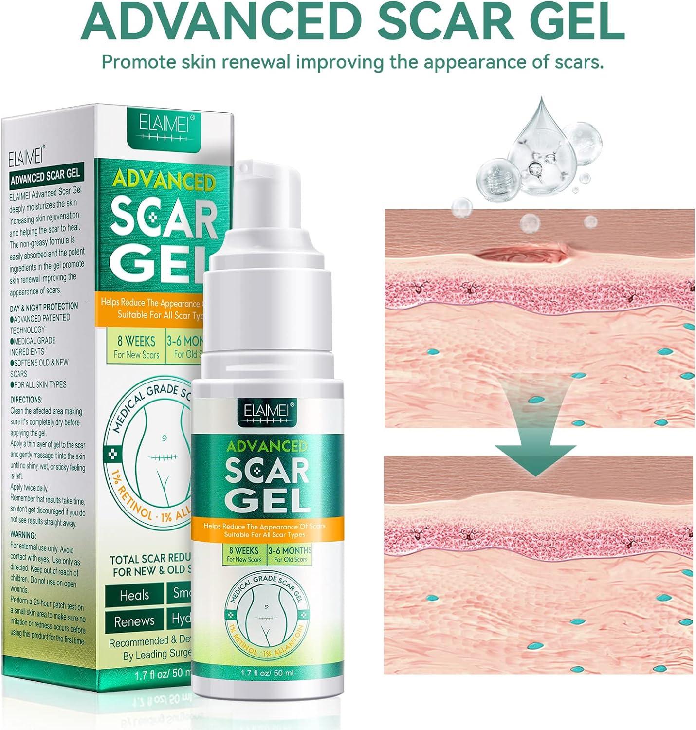 Scar Gel Cream - Advanced Treatment for Old & New Scars | Remove Scars ...