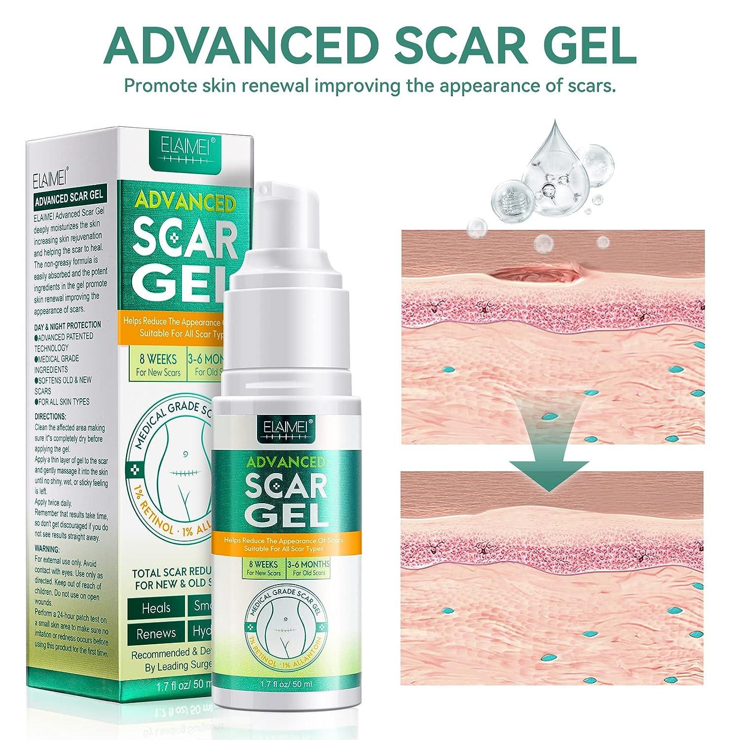 Advanced Scar Gel - Treatment for Old and New Scars - 1.7 fl oz 50ml ...