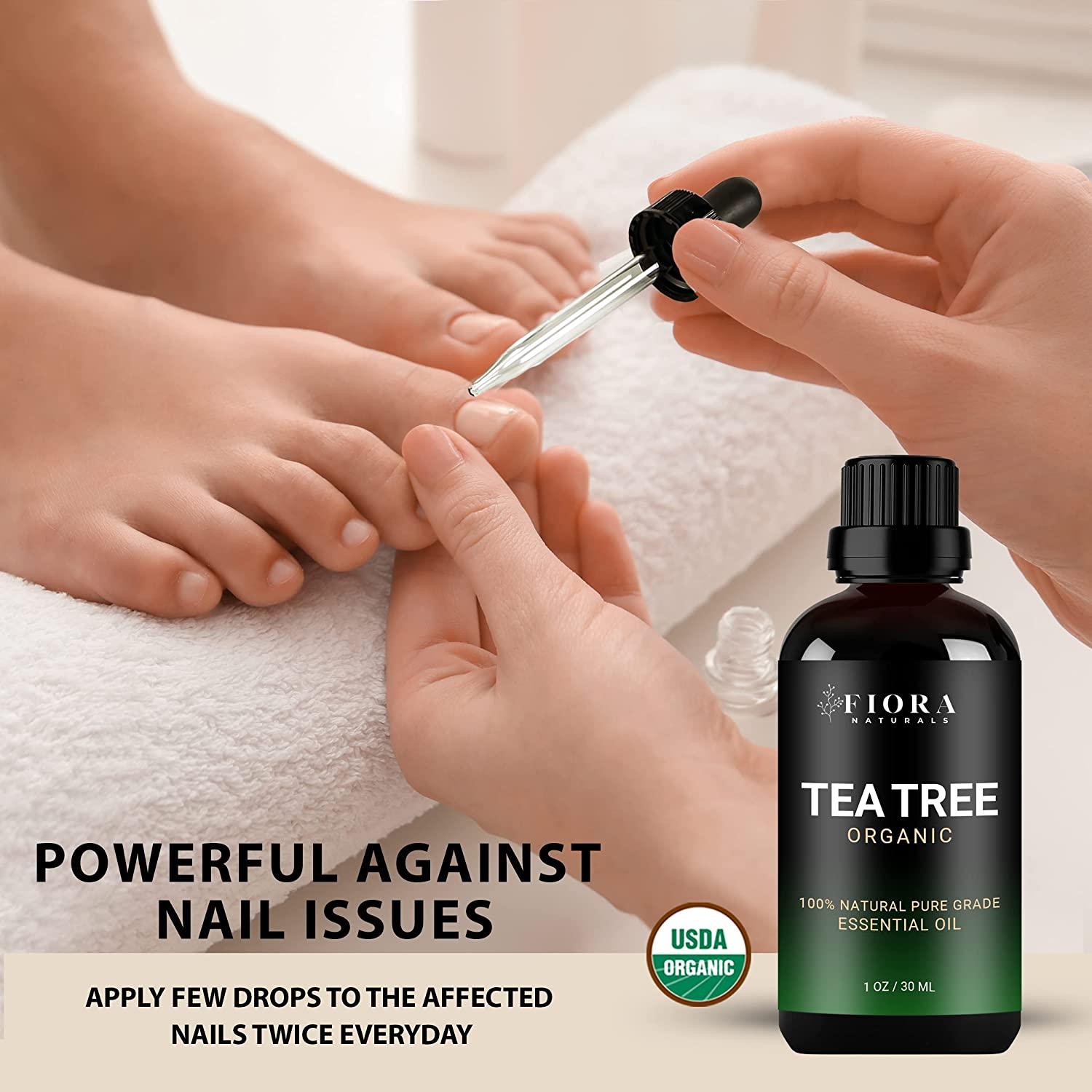 Fiora Naturals Tea Tree Essential Oil 1 oz - 100% Pure Organic ...