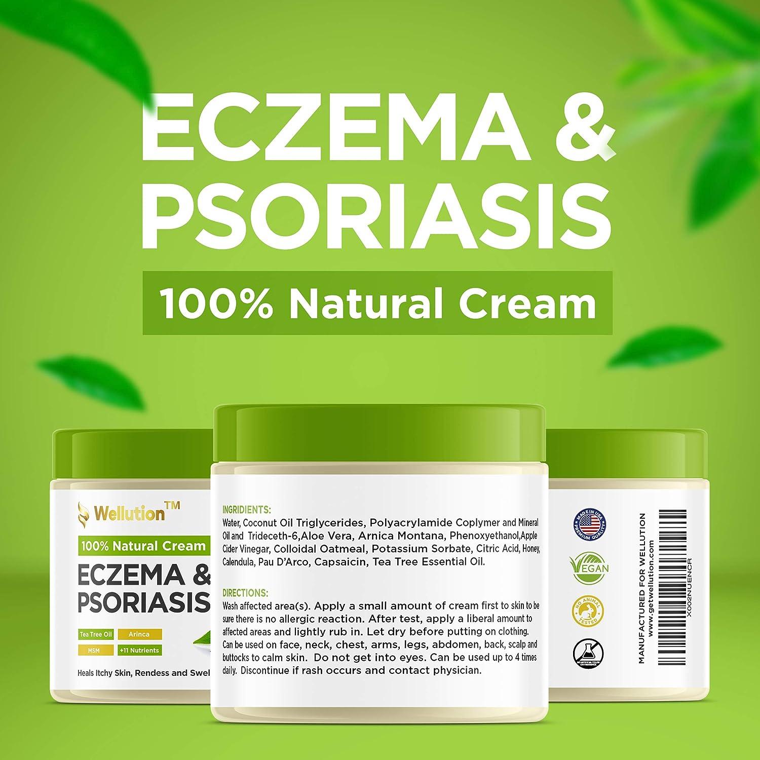 WELLUTION Natural Eczema and Psoriasis Cream - Intensive All-in-1 ...