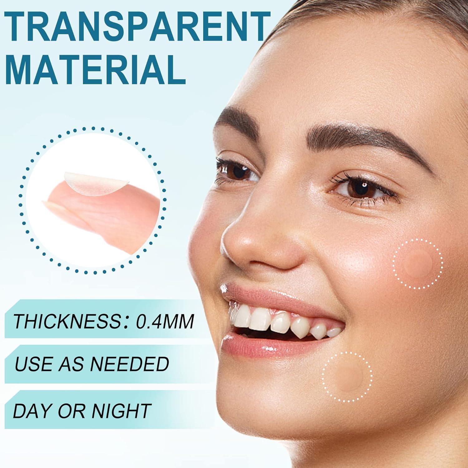 L otFancy Acne Patches 240 Count - Hydrocolloid Pimple Patches for Face ...