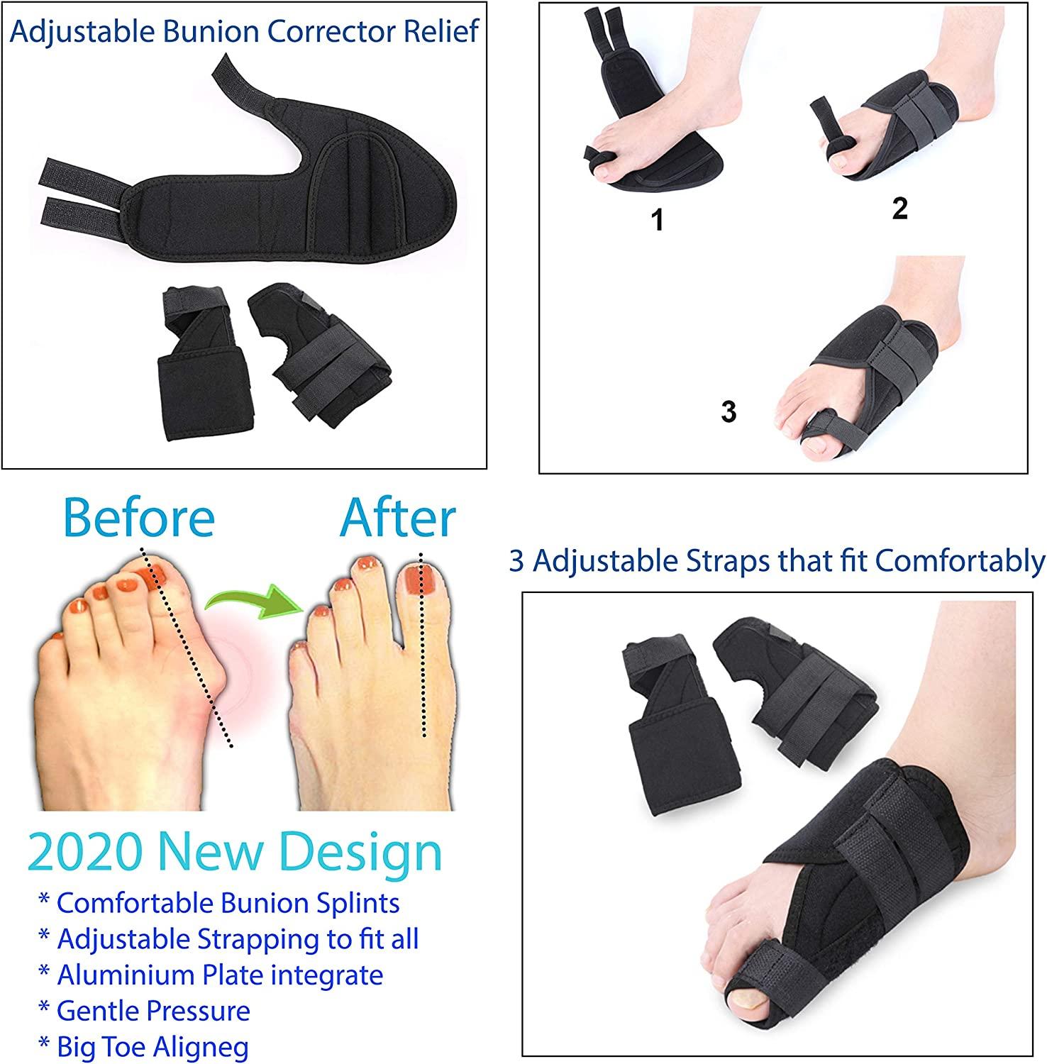 Bunion Corrector and Hallux Valgus Pain Relief Kit - Orthopedic Toe ...