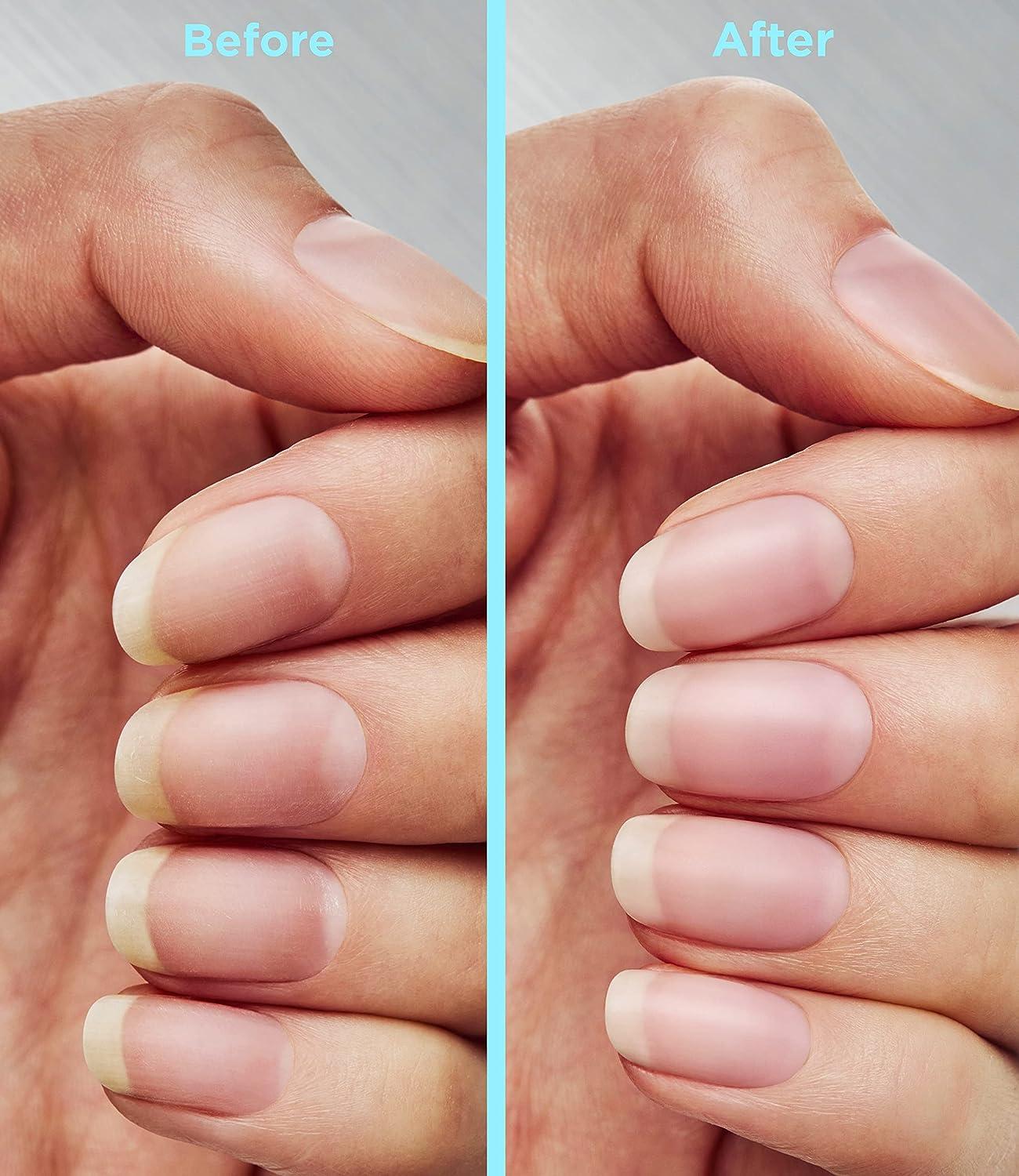 Sally Hansen Repair + Rescue Insta-Smooth Ridge Filler - Perfect Nail ...