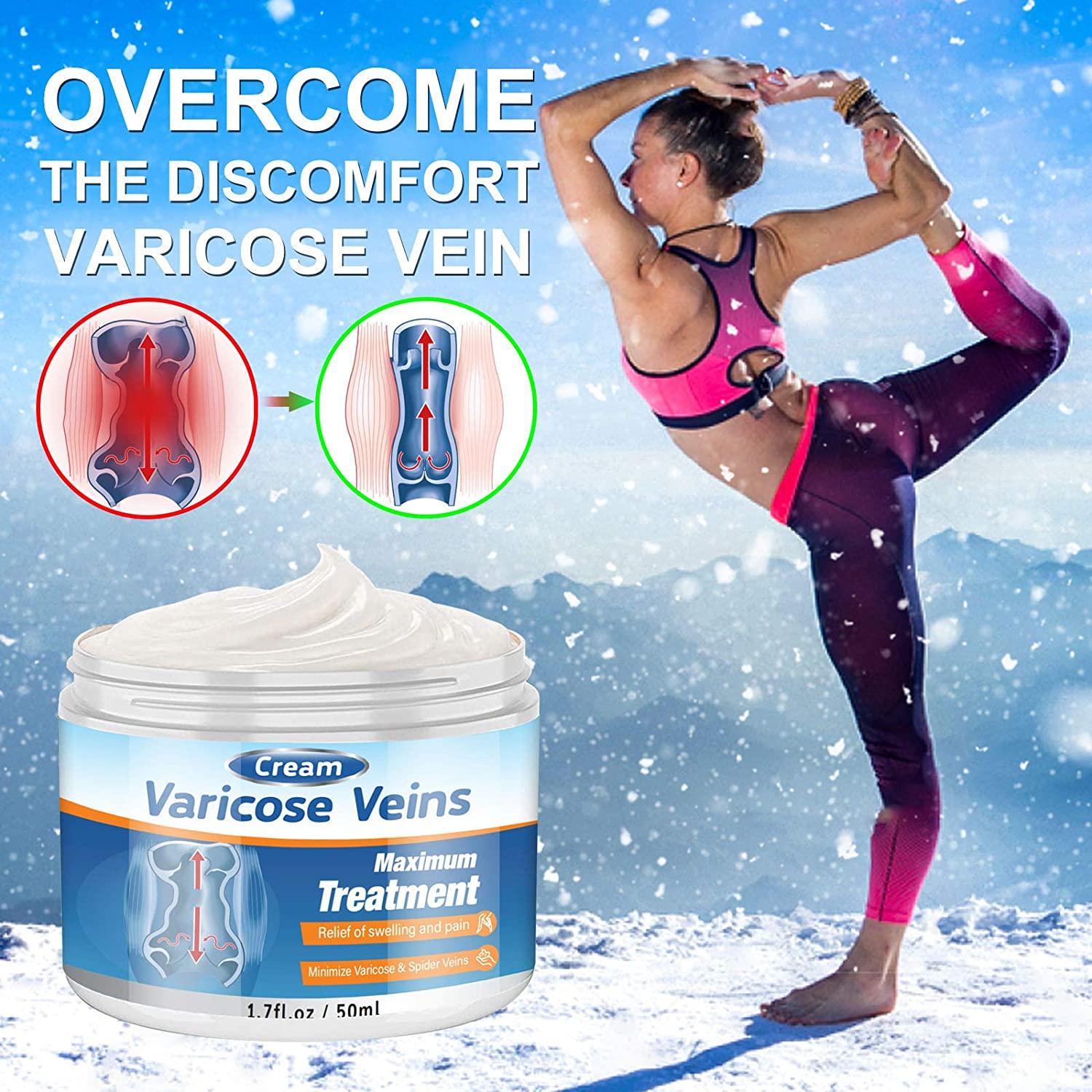 Varicose Veins Cream - Effective Treatment for Leg Relief, Phlebitis ...