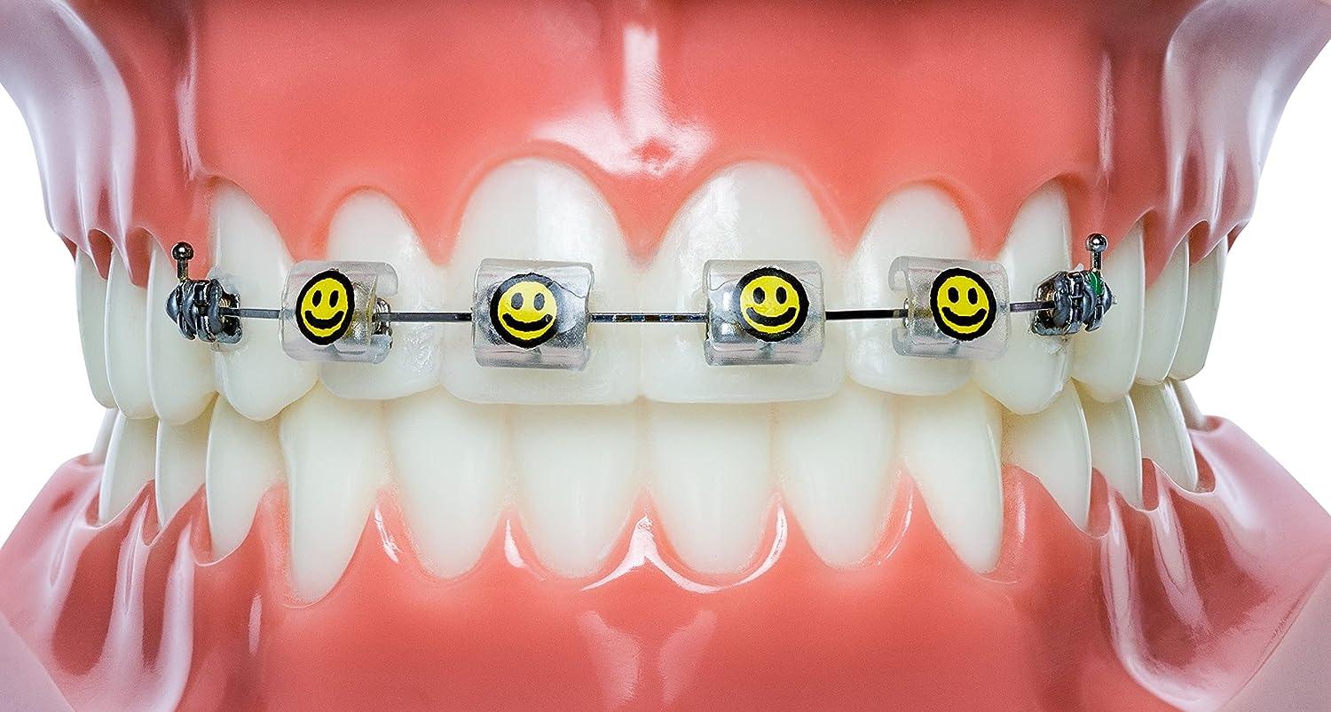 smiley face braces