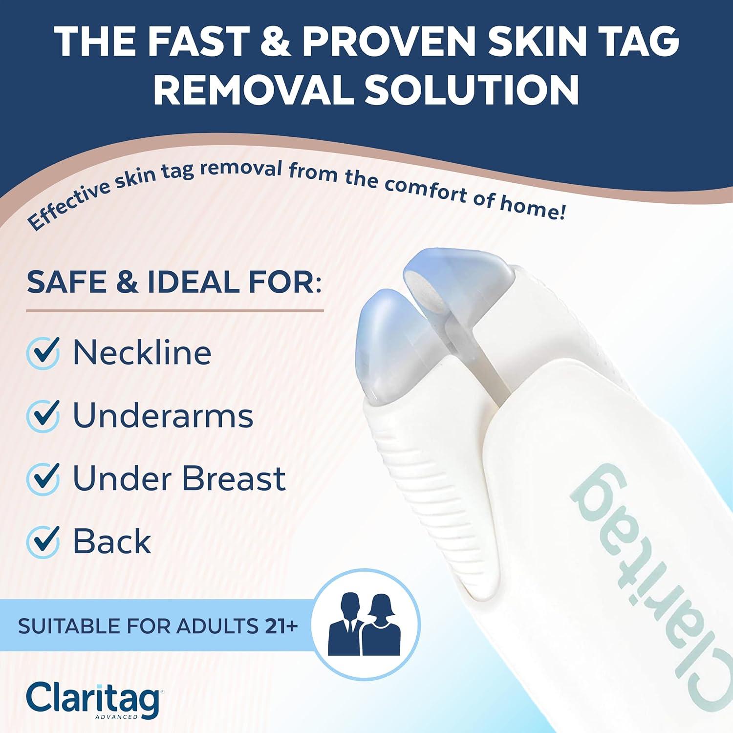 Advanced Skin Tag Remover - FDA-Cleared Cryogenic Freeze-Off Kit | Fast ...