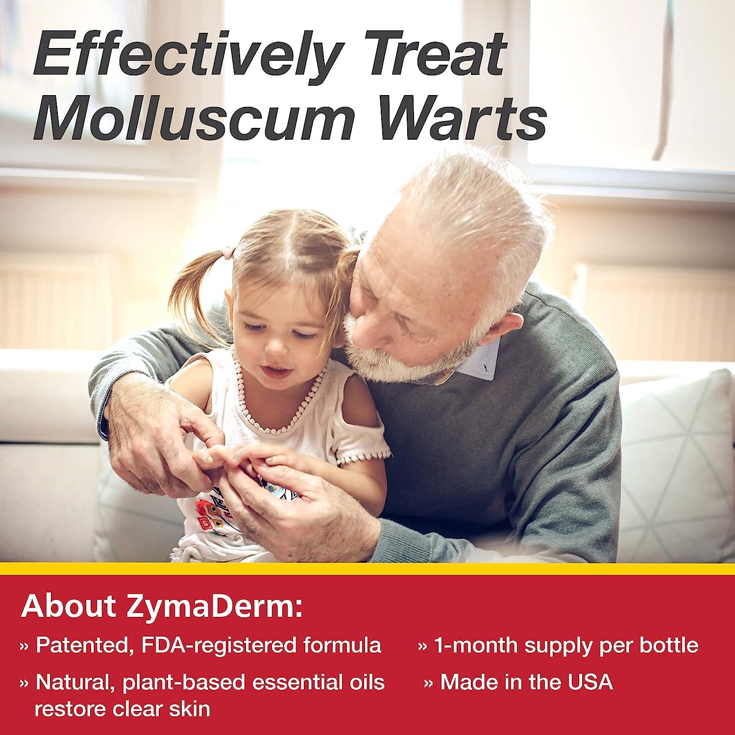 ZYMADERM Molluscum Contagiosum Treatment - Fast-Acting Discomfort-Free Reducer for Kids and ...