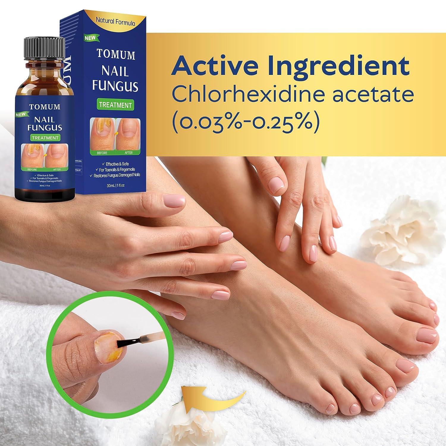 Extra Strength Toe Nail Fungus Treatment for Healthy Nails - Fingernail and Toenail Repair Solution