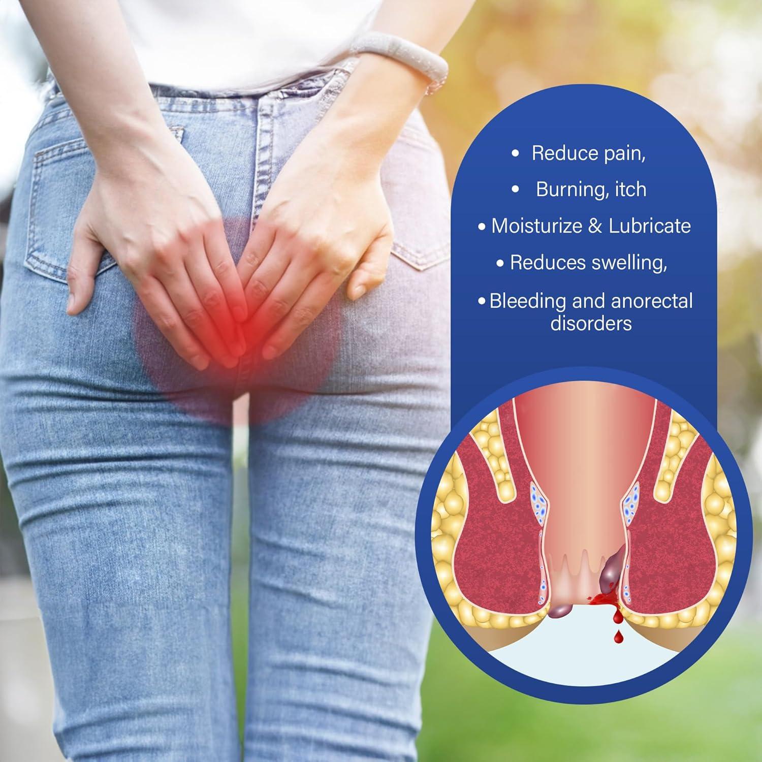 Maximum Strength Hemorrhoid Treatment Ointment - Herbaluxy Cure for ...