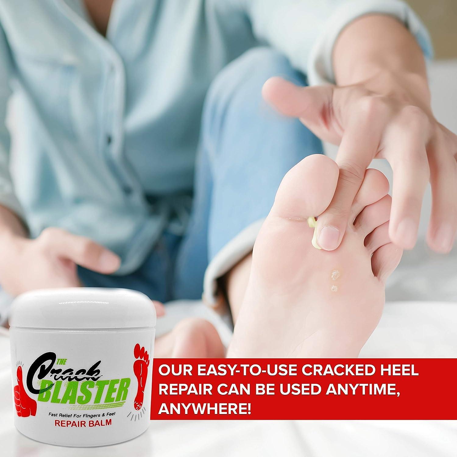 Crack Blaster Repair Balm - Intense Treatment for Dry Cracked Heels ...