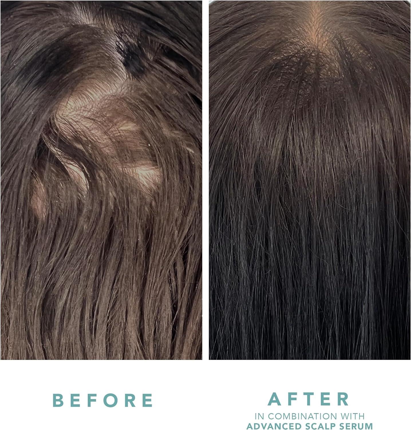 WE ARE PARADOXX Growth Scalp Serum with Trioplexx Technology ...