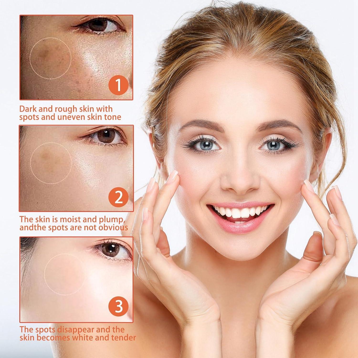Melanin Correcting Cream Moisturizing Repair Cream Lefun Melanin Cream ...