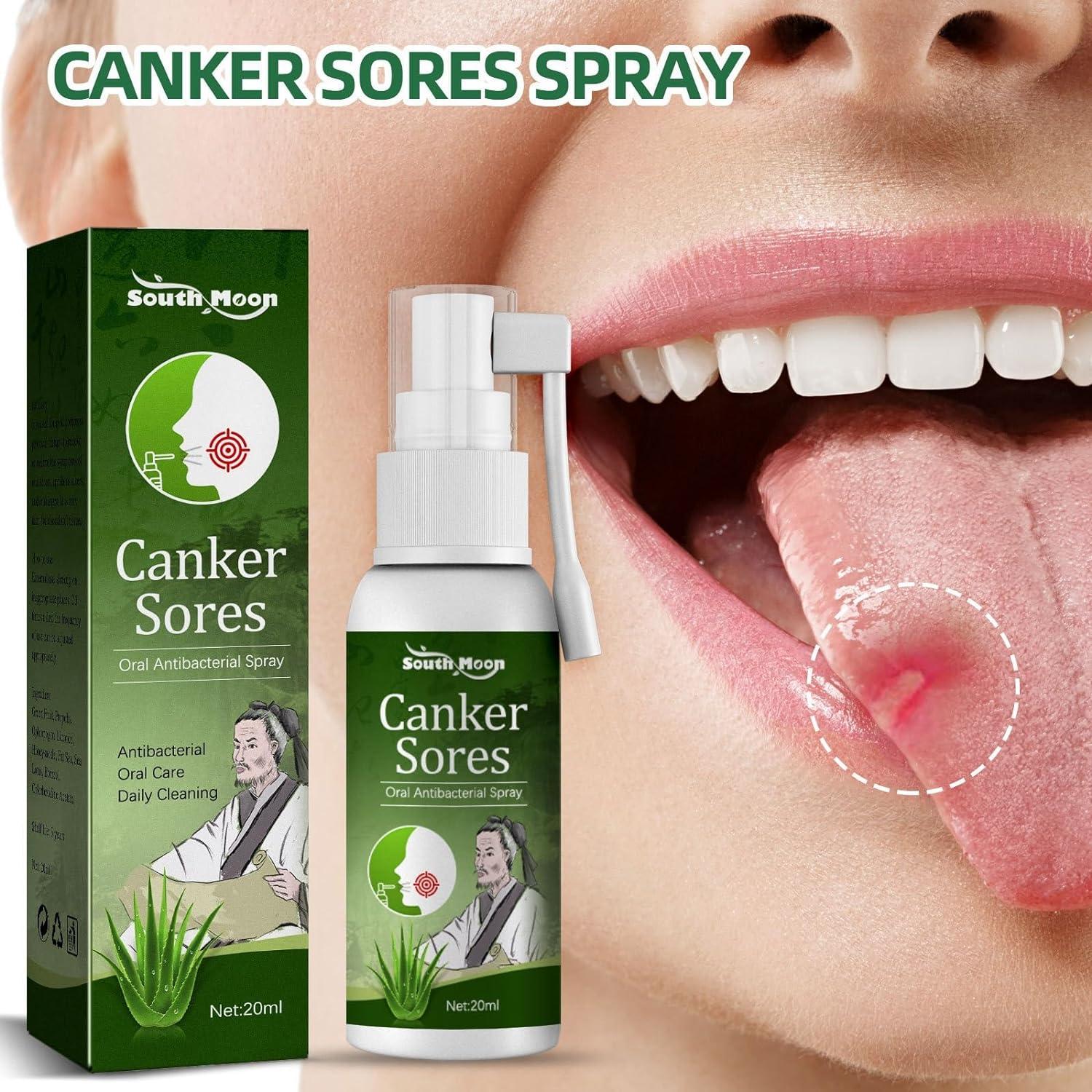 Mouth Ulcer Spray Mouth Ulcer Treatment Spray for Adluts Ulcer Breath ...