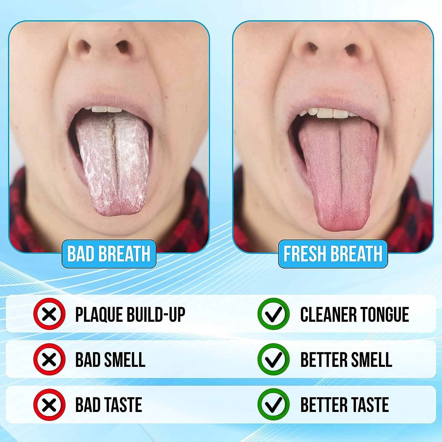 Tongue Scraper for Adults & Kids - Stainless Steel Cleaner for Bad ...
