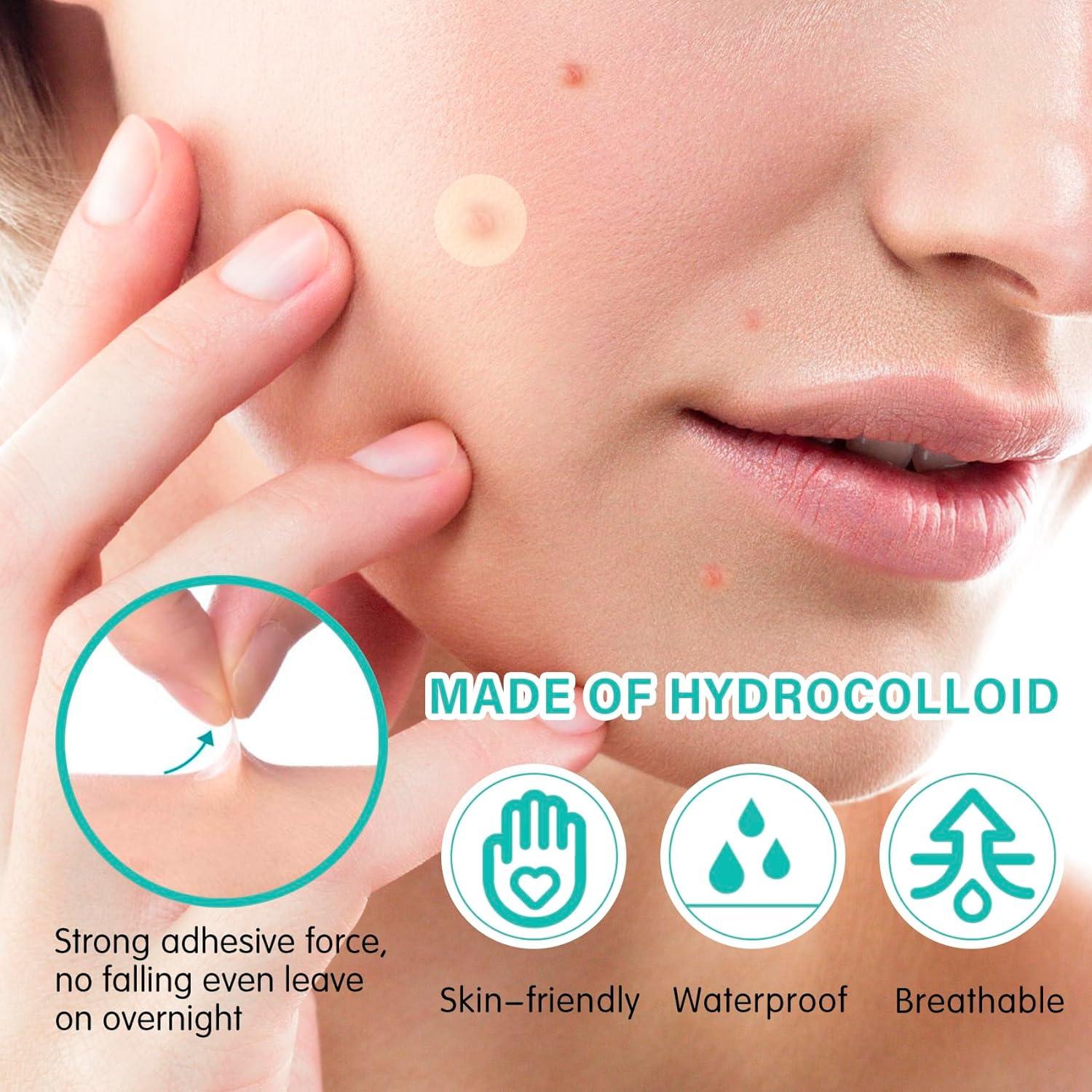 Pixline Pimple Patches - 300 Count Tea Tree Oil & Salicylic Acid Acne ...
