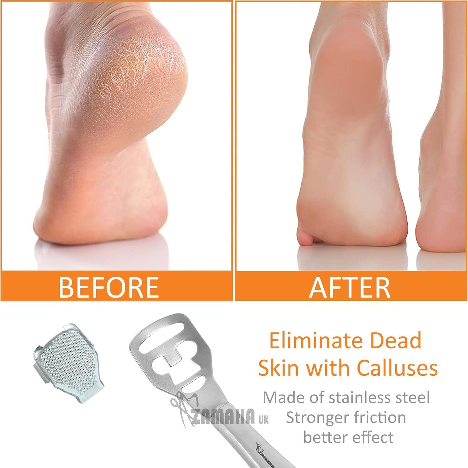 ZAMAHA UK Callus Remover Hard Skin Remover Foot Heel Shaver Pedicure ...