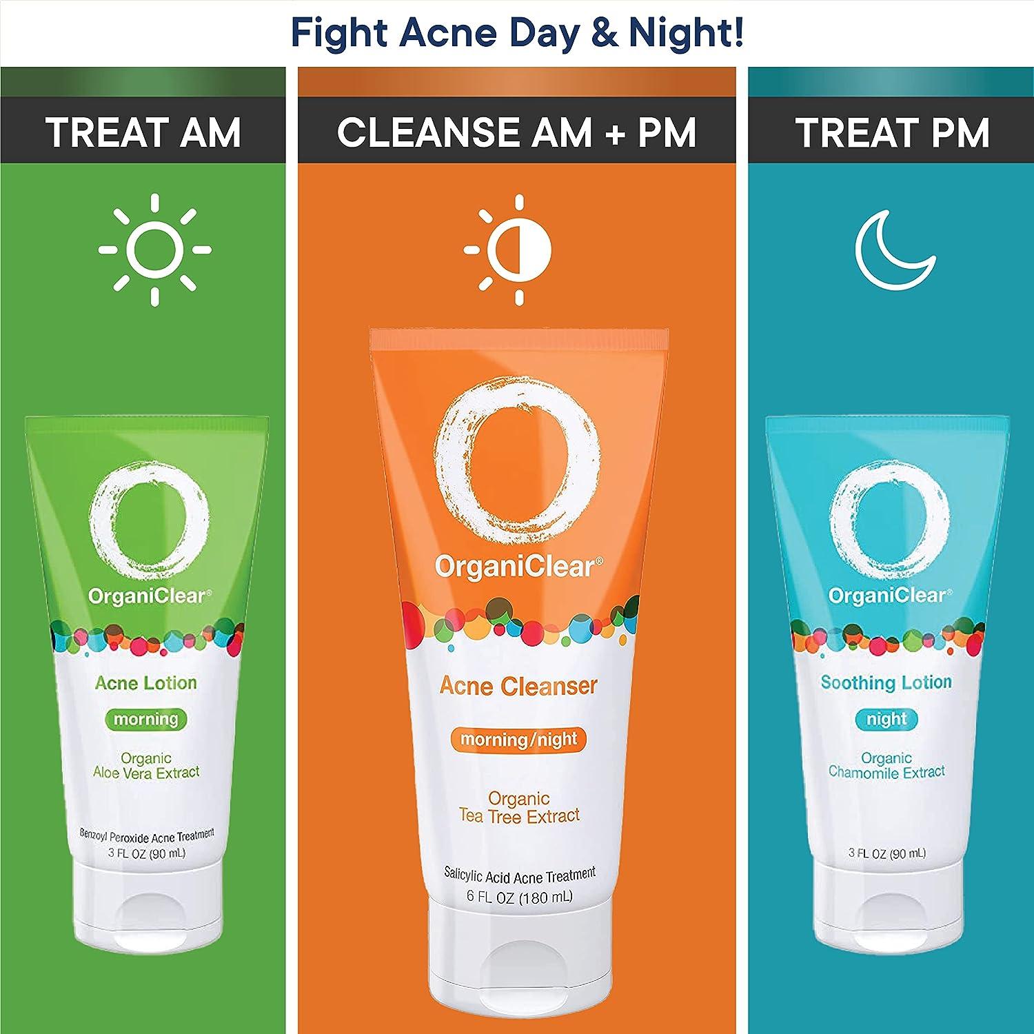 OrganiClear Acne Treatment System Kit - Benzoyl Peroxide Cream ...