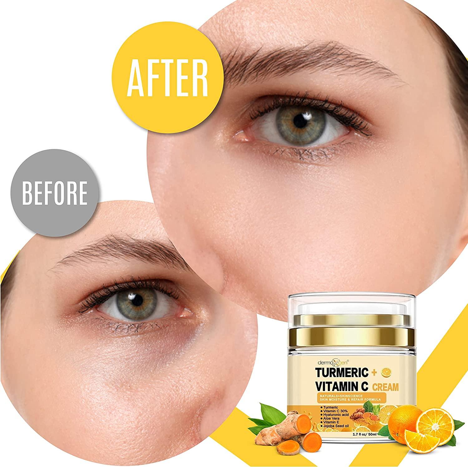 Glow-Boosting Turmeric & Vitamin C Moisturizing Cream - Organic Anti-Aging Formula for All Skin ...