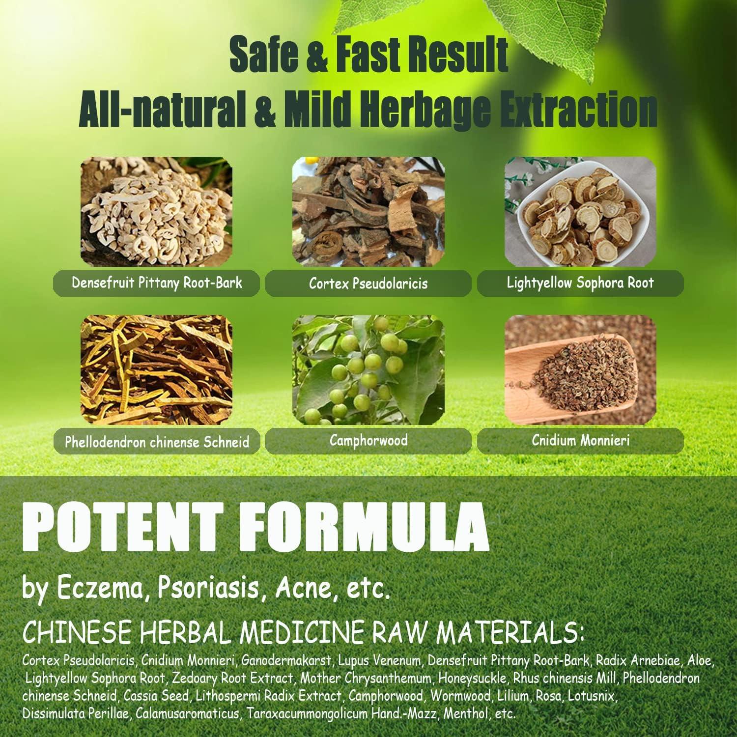 All Natural Eczema And Psoriasis Cream For Sensitive Skin Herbal Anti