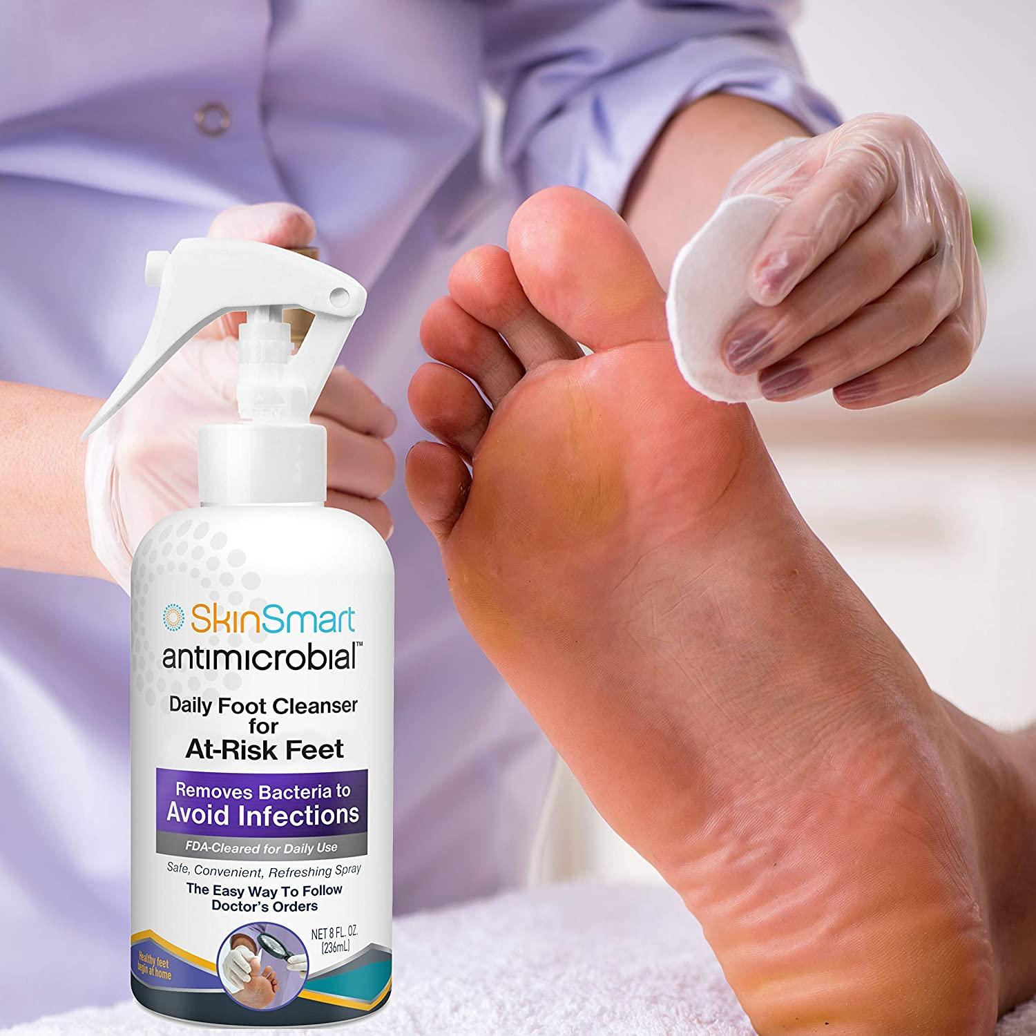 SkinSmart Daily Foot Cleanser - 8oz Spray | Removes Bacteria, Prevents ...