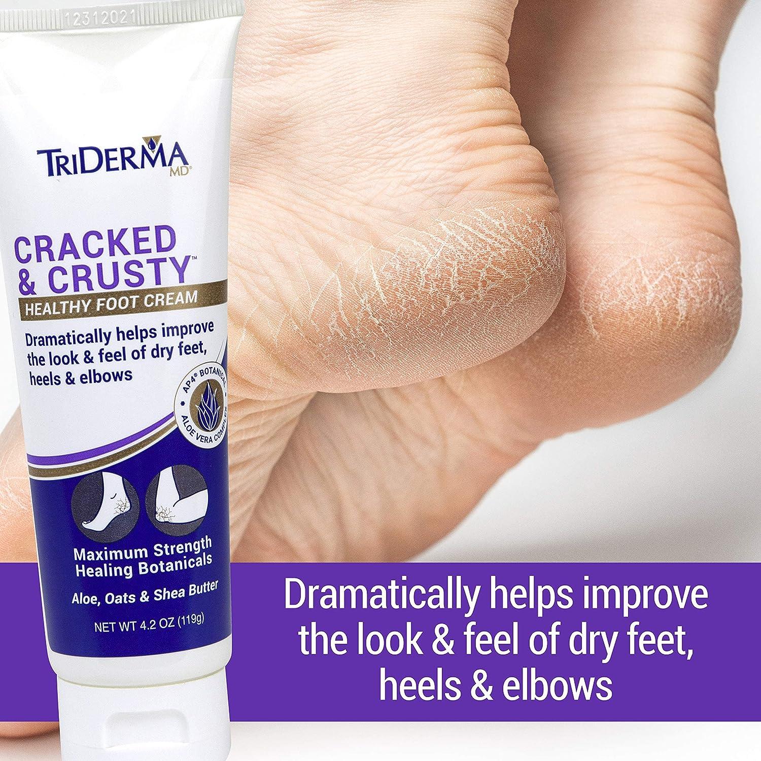TriDerma Cracked & Crusty Foot Cream - Moisturizes, Softens, and Heals ...