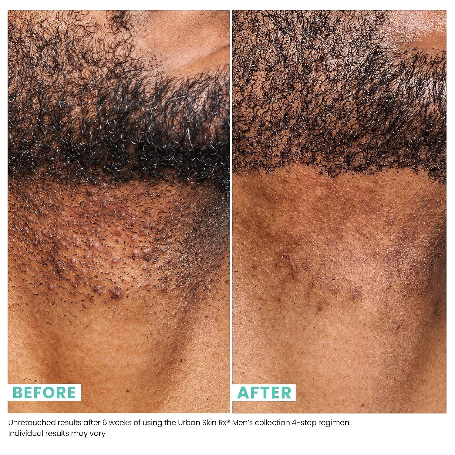 Urban Skin Rx Daily Men's Exfoliating Face Wash + Scrub | 2-in-1 ...