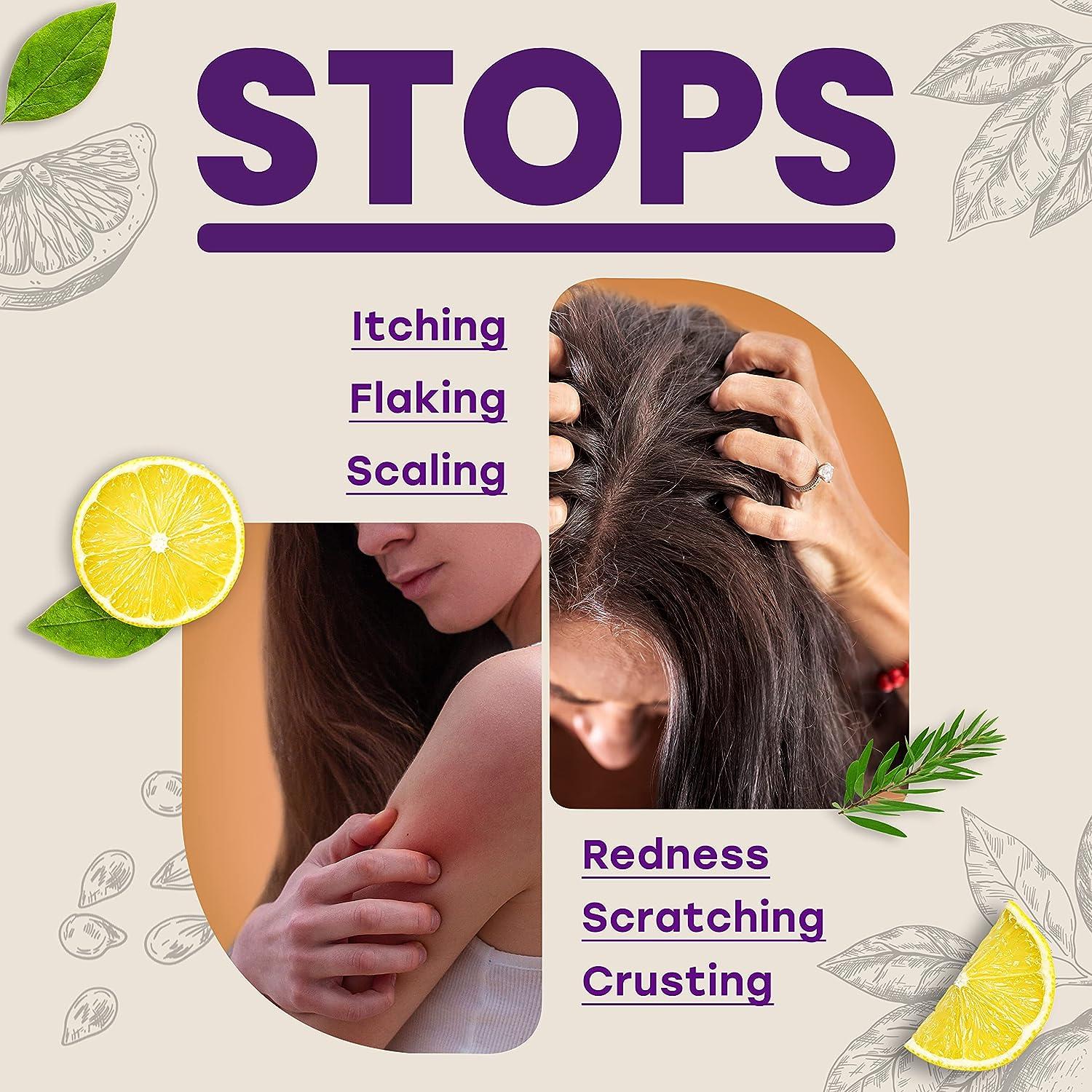 Massey's CF 100% Natural Probiotic Lemon Body Soap - 4oz | Refreshing ...