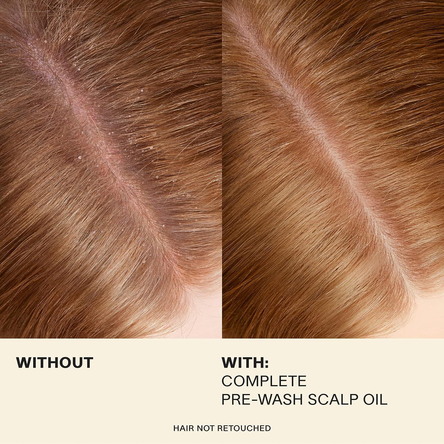 JVN Pre-Wash Scalp Oil & Hair Treatment - Sulfate Free Dry Scalp ...