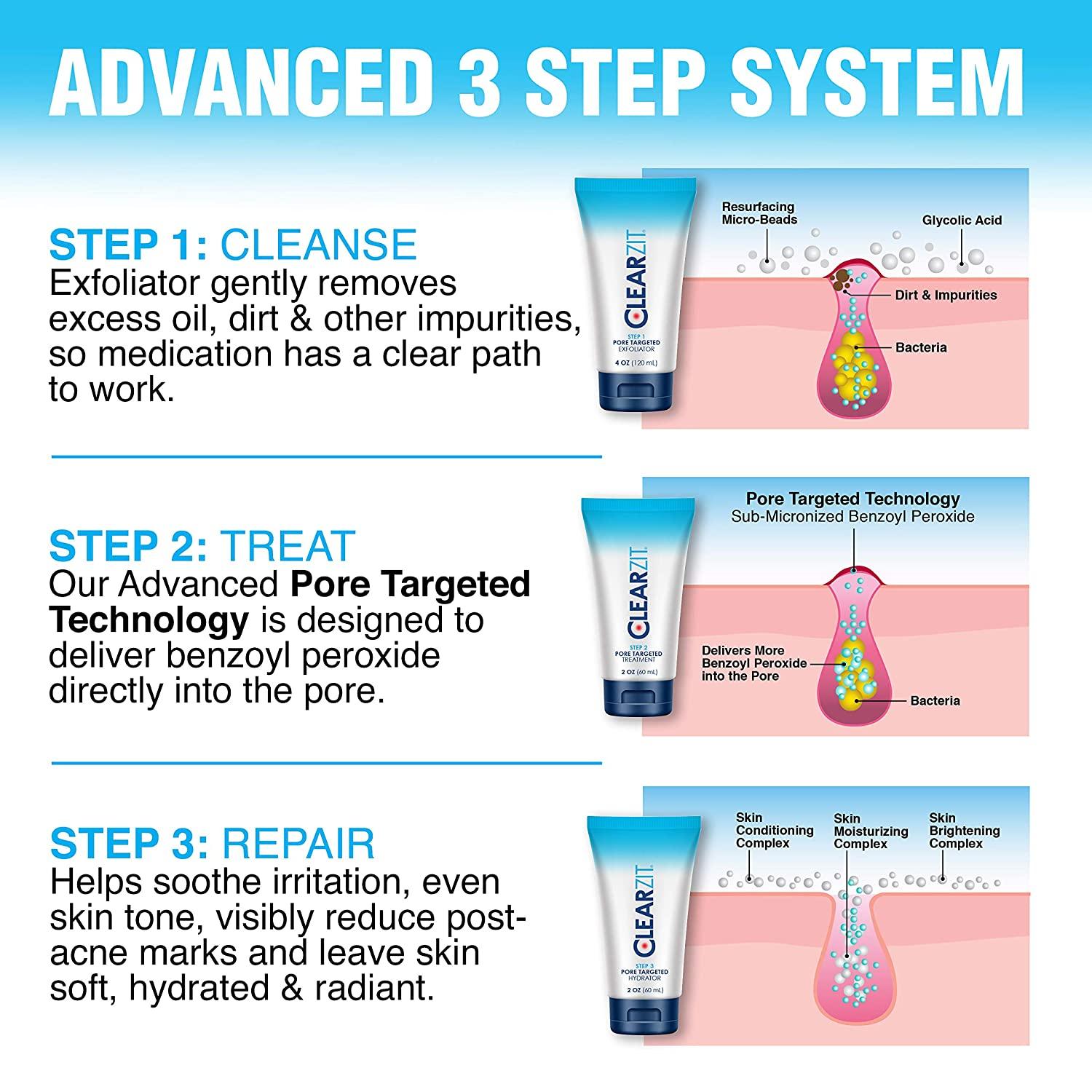Clear Zit Acne Treatment Kit - 3 Step Pore Targeting System | Buy Now ...