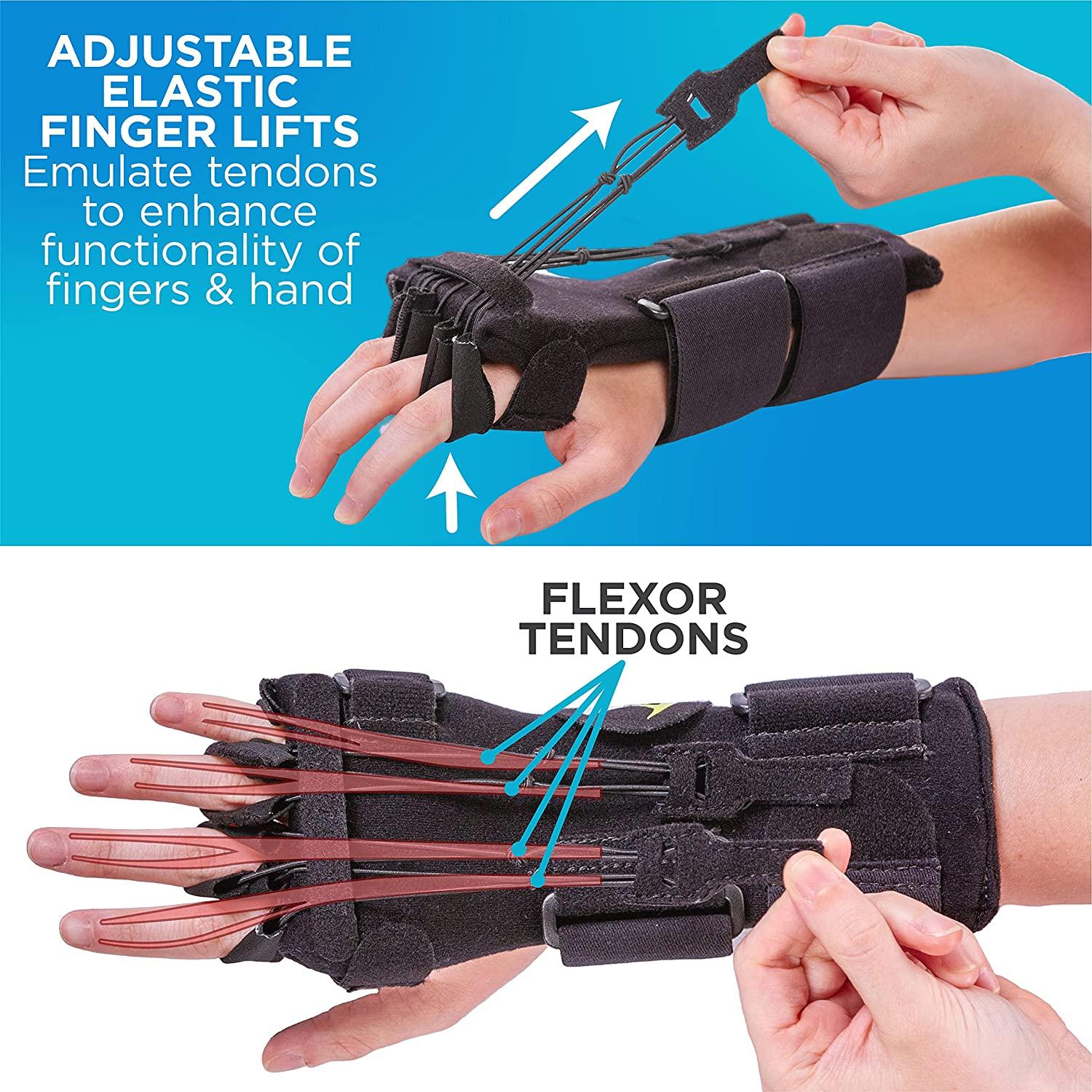 BraceAbility Radial Nerve Palsy Splint - Dynamic Brace for Wrist Drop ...