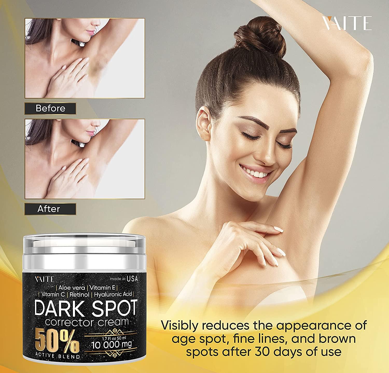 Dark Spot Remover Cream for Face, Body, Bikini & Sensitive Areas ...