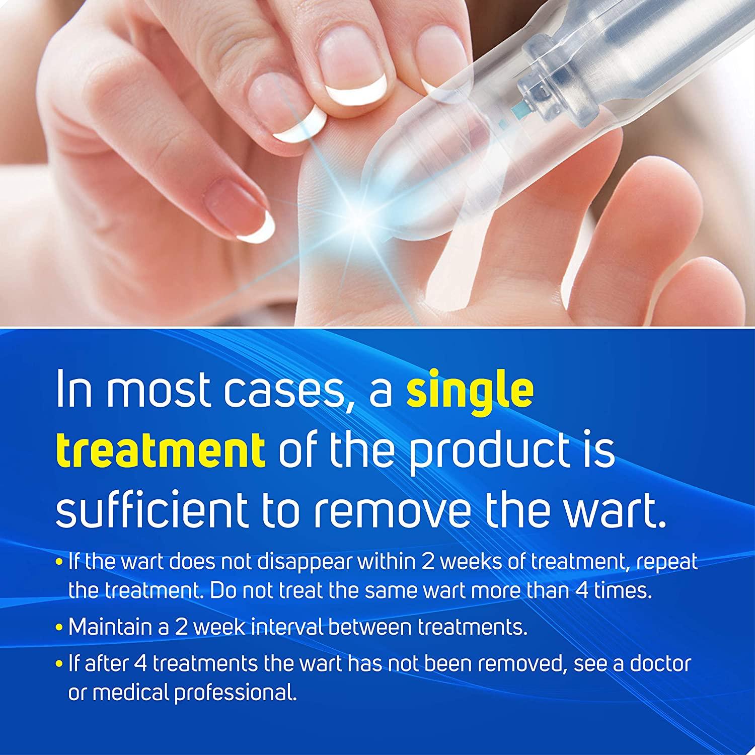 Cryogenic Wart Remover Freeze | Care Science 8 Applications for Common ...