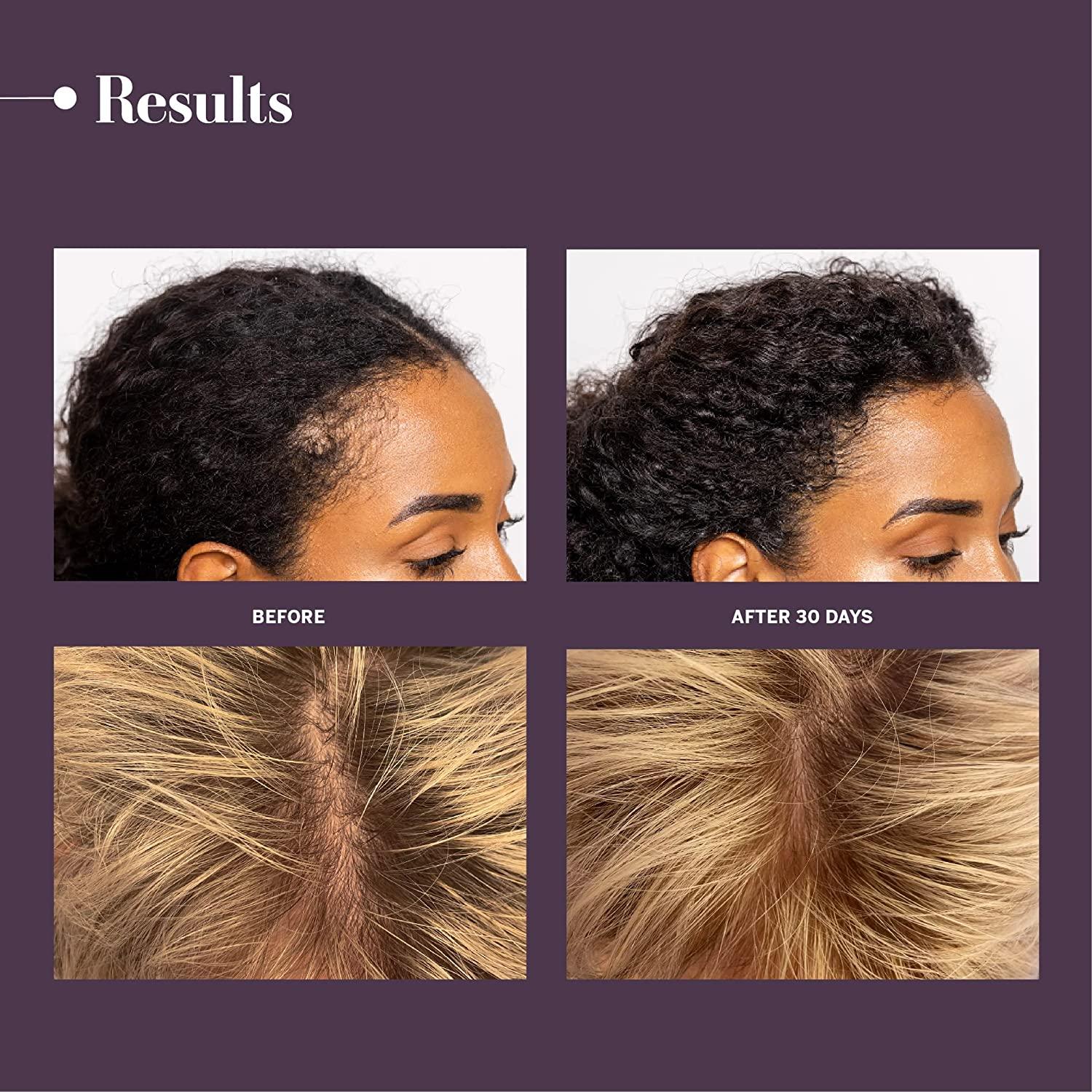 Inala Power Potion | Rice Water Complex Serum for Scalp Health & Hair ...