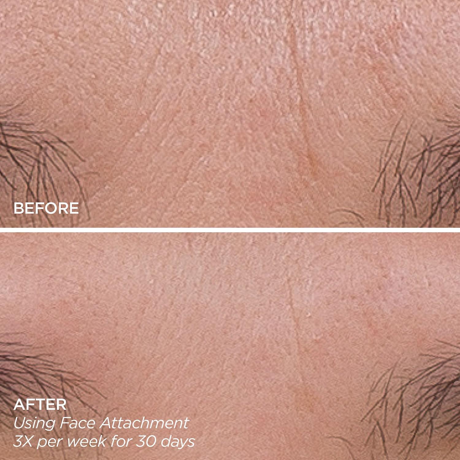 Shop BeautyBio Get That Glow - GloPRO Microneedling Tool & Discovery ...