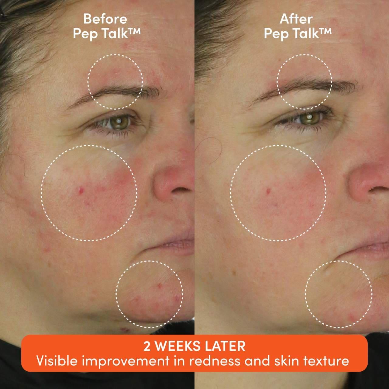 Shop Lion Pose Pep Talk Barrier Repair Cream with Peptides + Ceramides ...