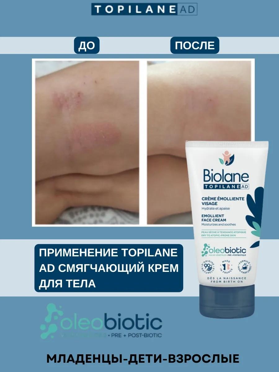 Biolane Mitigating facial cream and age emolet from birth 50ml | Buy ...