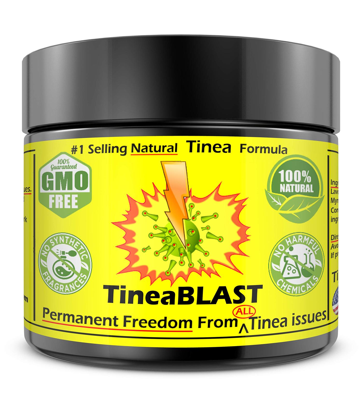 Best Tinea Versicolor Treatment Cream: Fast Relief for Tinea Pedia ...